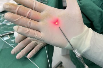 LHP Laser Hemorrhoidoplasty: Pain Free life