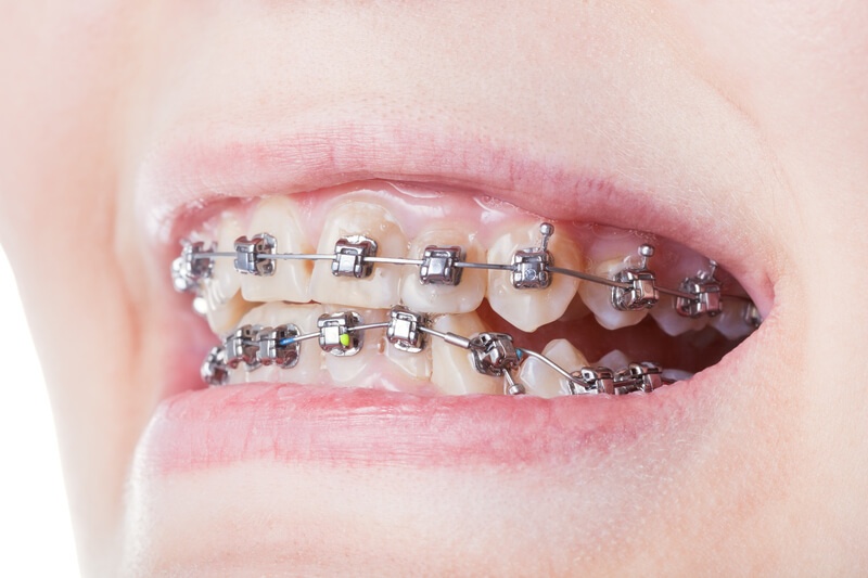 New Era of Orthodontic Treatment